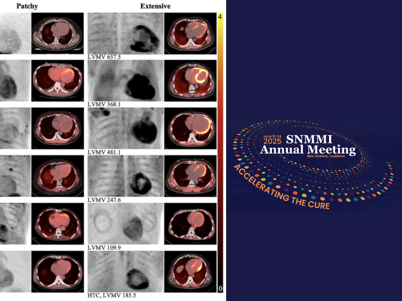 Novel PET Imaging Approach Detects Heart Damage in Patients with Non ...